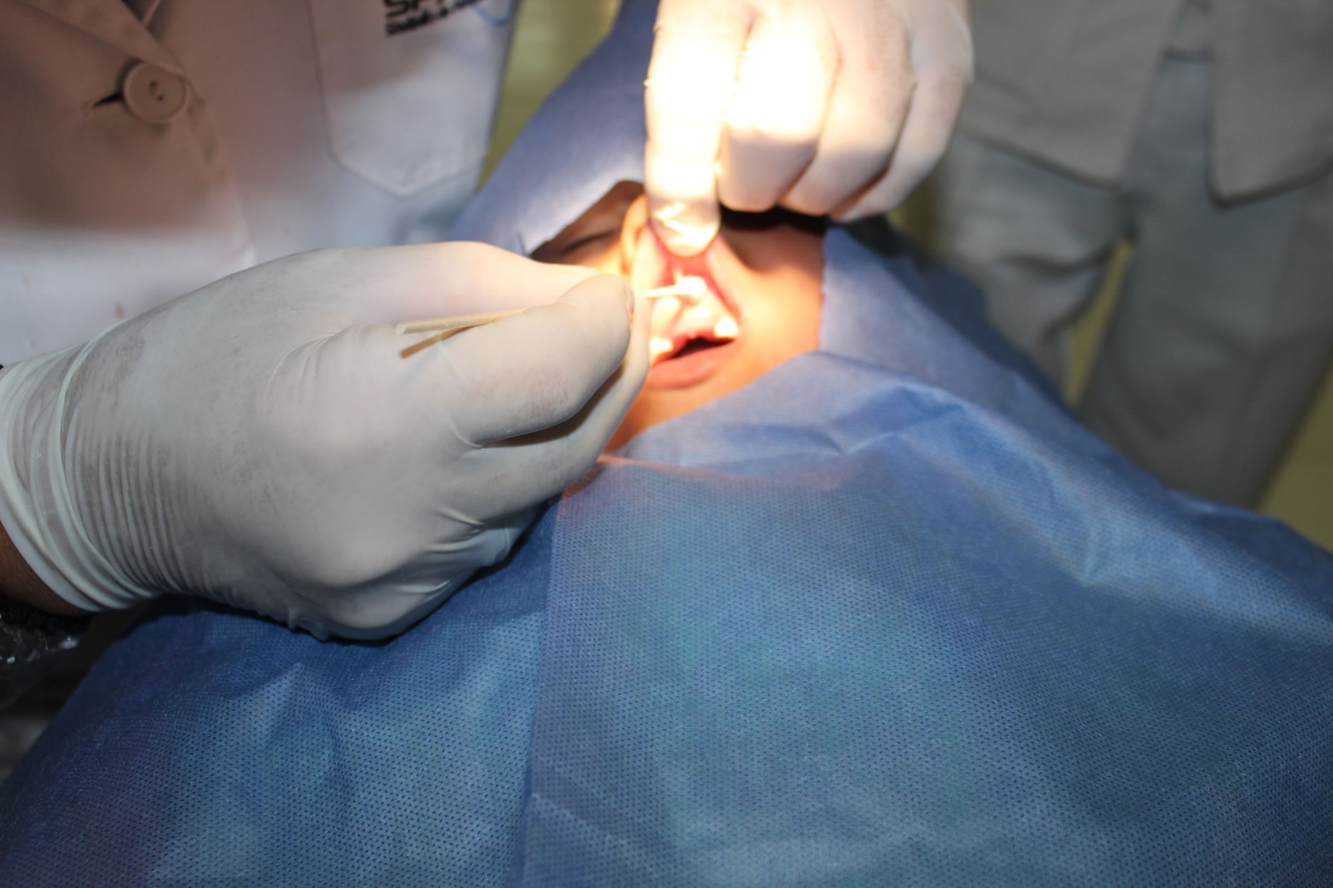 Ojal Quirúrgico (Ulectomia)