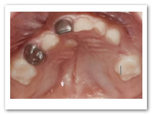 Scientific Bulletin :: UAEH